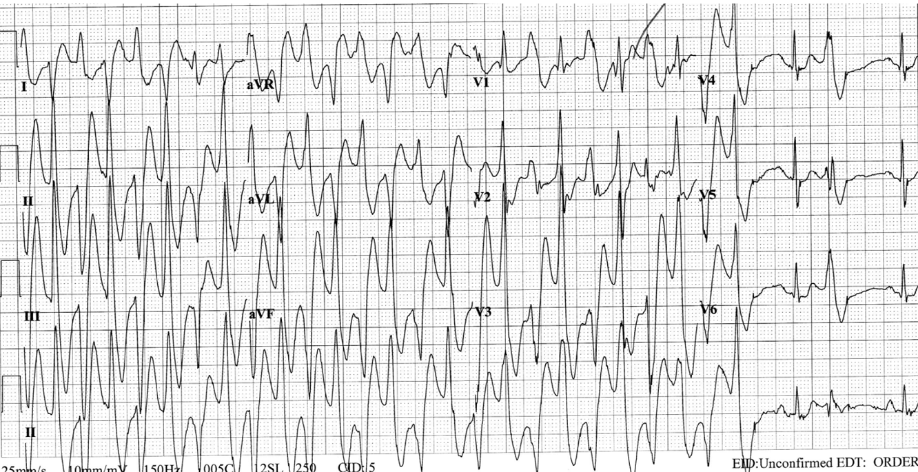 SCA Myths vs Facts #2